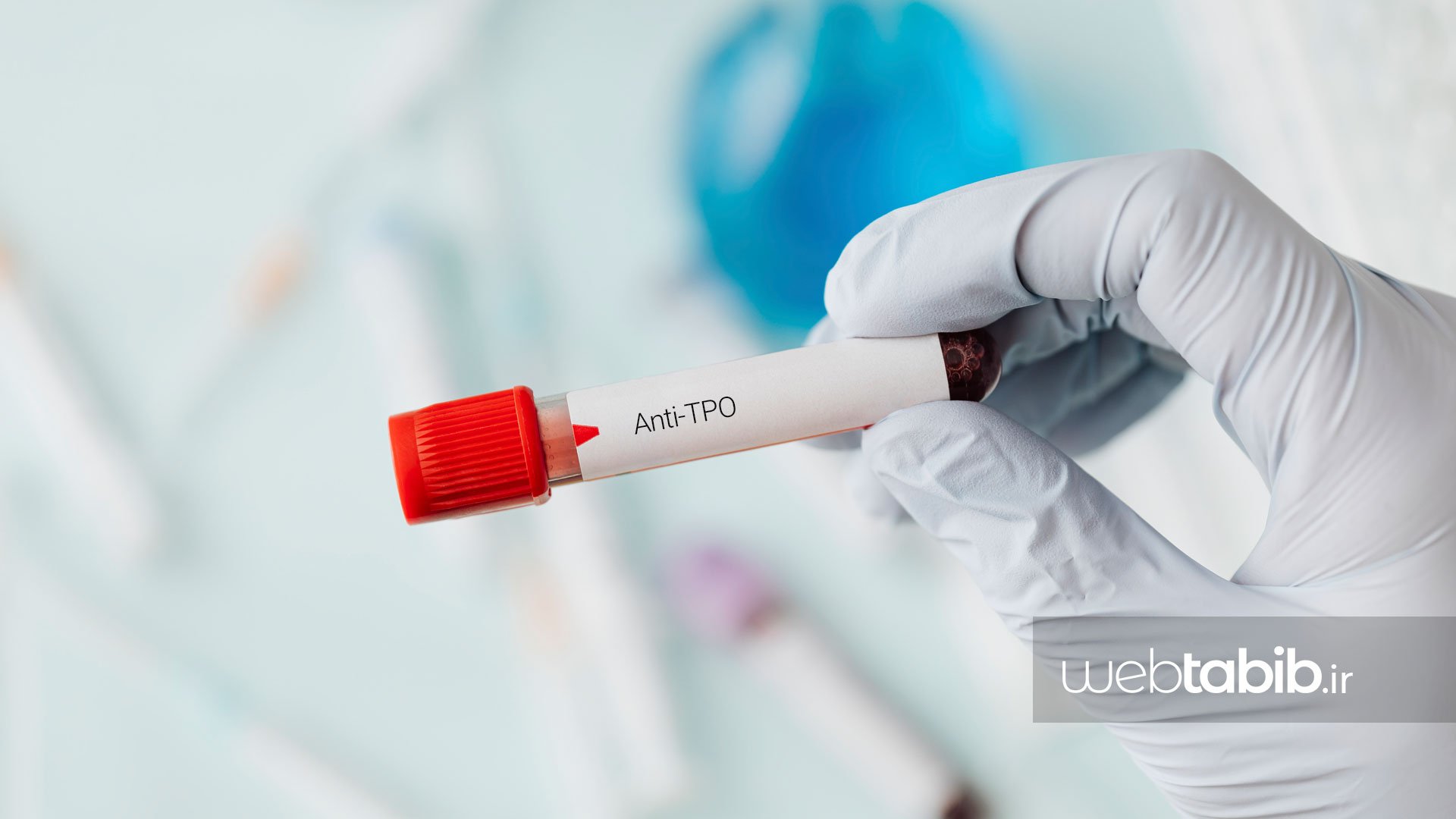 آزمایش Anti TPO: تفسیر بالا بودن و میزان نرمال